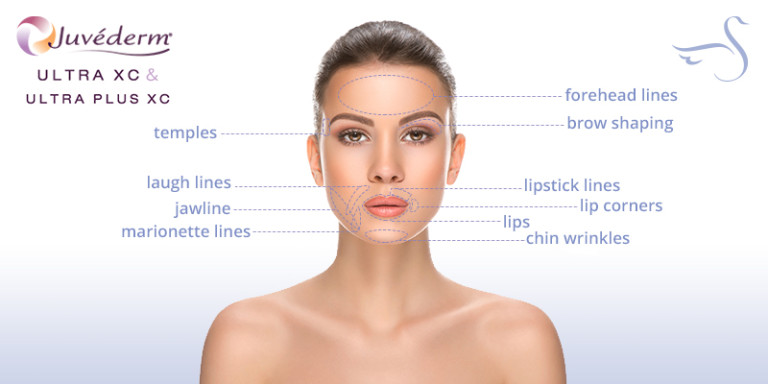 Ageless Skin Juvederm Ultra Plus | Perfect Skin Aesthetic MedSpa